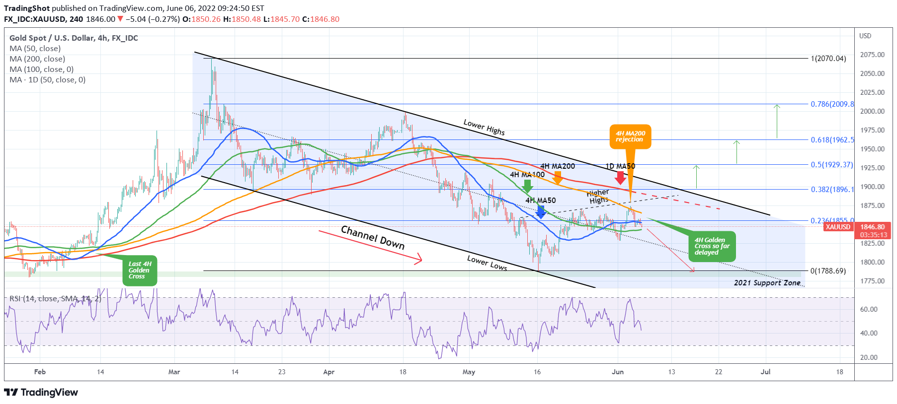 FX_IDC:XAUUSD Idea Chart Image by TradingShot — TradingView