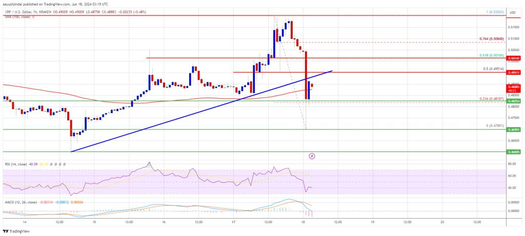 XRP Bulls Flex Muscles: Potential Uptrend in Play? — TradingView News
