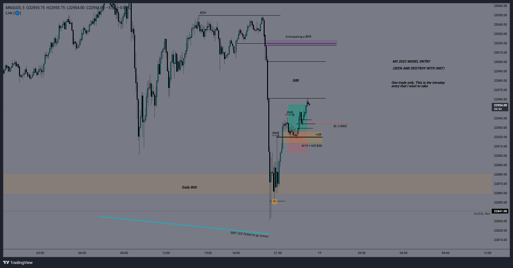 /MNQ Chart Image — TradingView